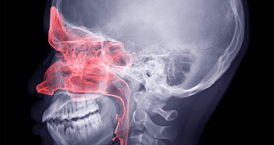 Innovative Treatment for Chronic Rhinitis is Safe and Effective