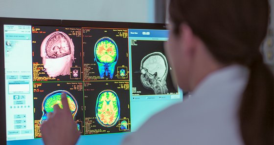 Access the Nervous System through the New Neuroscience PhD Program