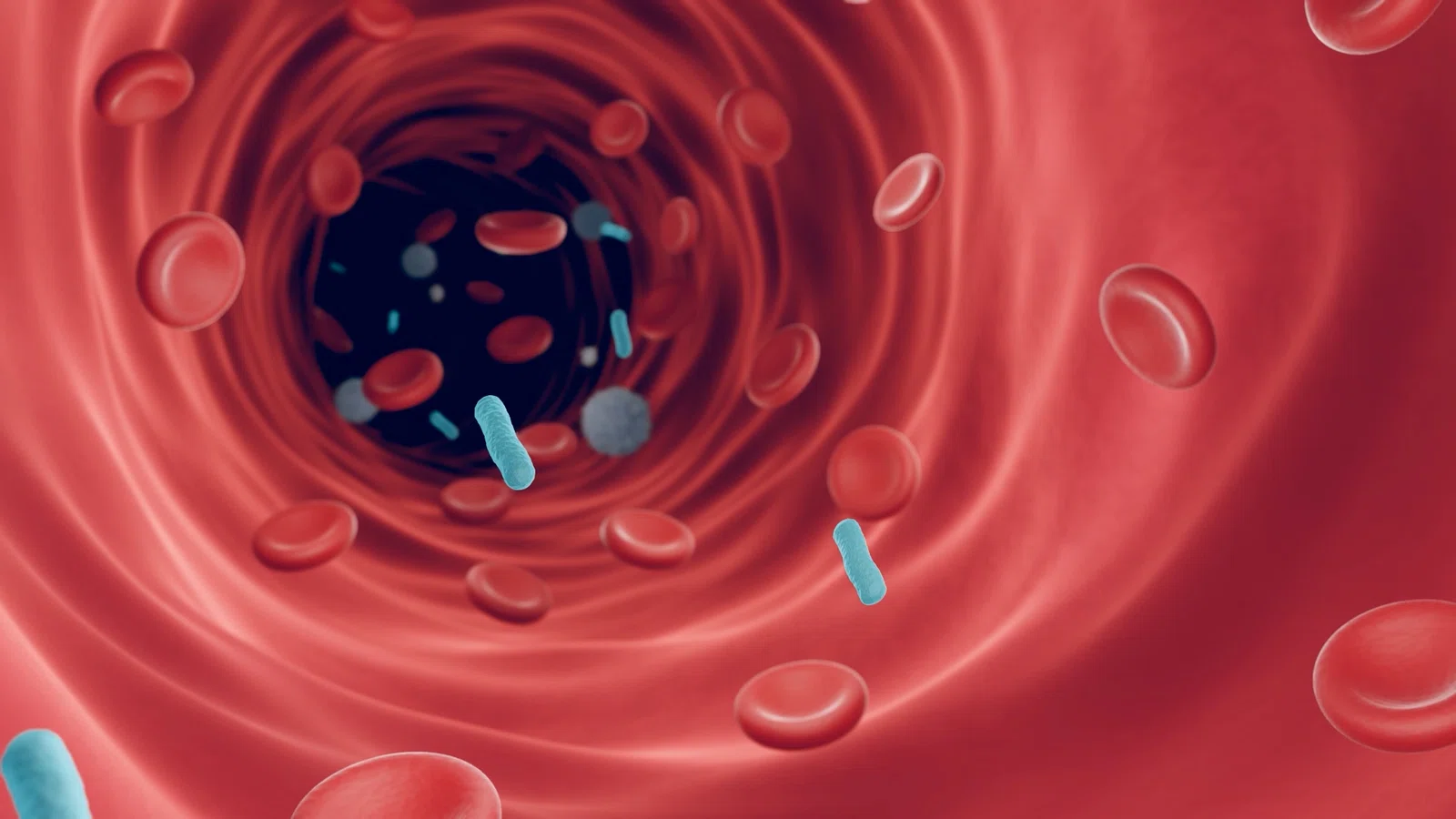 Shifting the Sepsis Paradigm