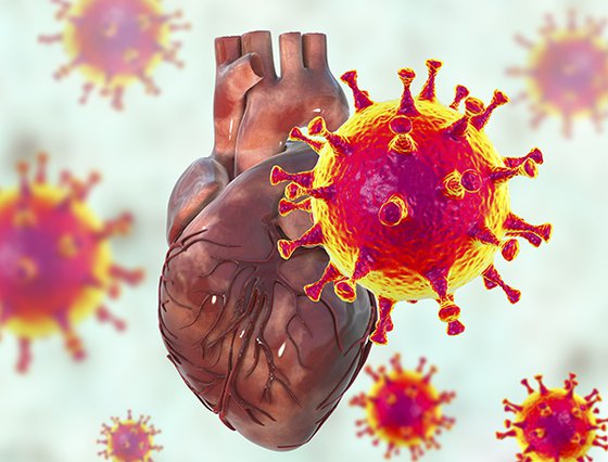 Exploring New Horizons in Viral Myocarditis: The TRIM29-PERK Pathway