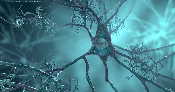 New FDA-Approved Drug Could Be the Much-Awaited Panacea for Alzheimer’s