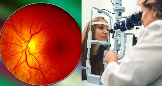 Improved options for patients with severe retinal vascular disease