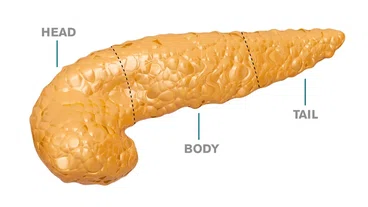 Pancreatic Cancer of The Head and Body/Tail Regions Are Distinct ...